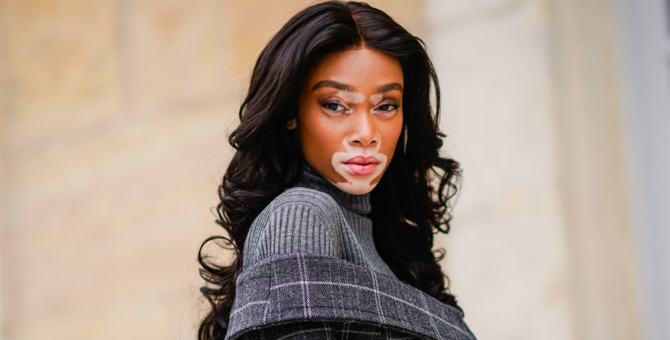 9 Iconic women who made their unique features their signature | Buro 24 ...